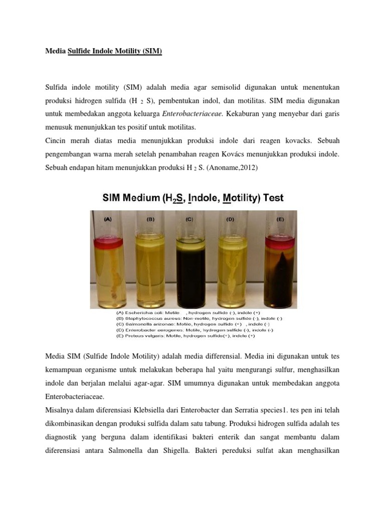 Media Sulfide Indole Motility | PDF