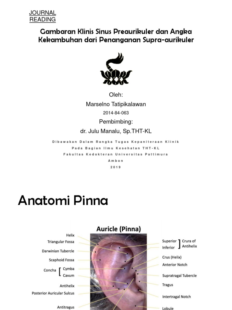 Sinus Preauricular | PDF