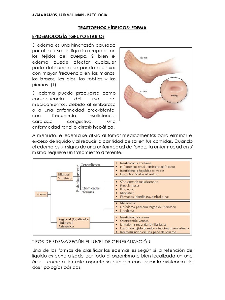 Tipos y Causas del Edema: Guía Completa | PDF | Edema | Especialidades ...