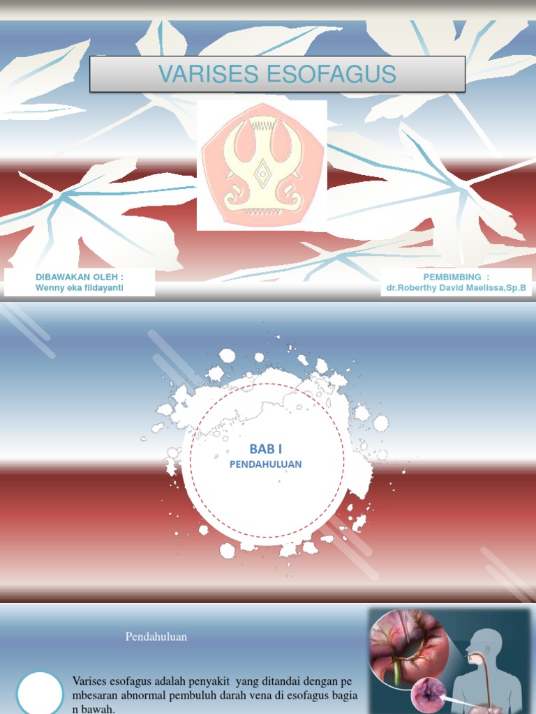 Varises Esofagus | PDF
