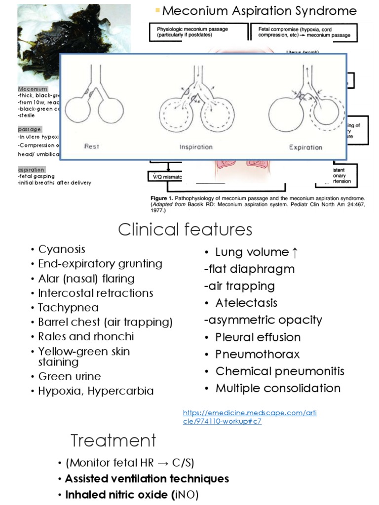 Meconium: - Thick, Black-Green, Odorless - From 10w, Reach 200g at ...