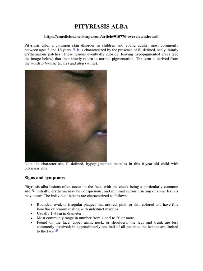 Pityriasis Alba In Adults