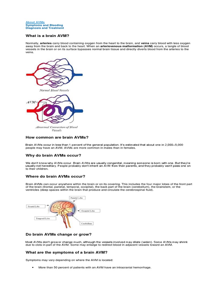 What Is A Brain AVM?: Symptoms and Bleeding Diagnosis and Treatment ...