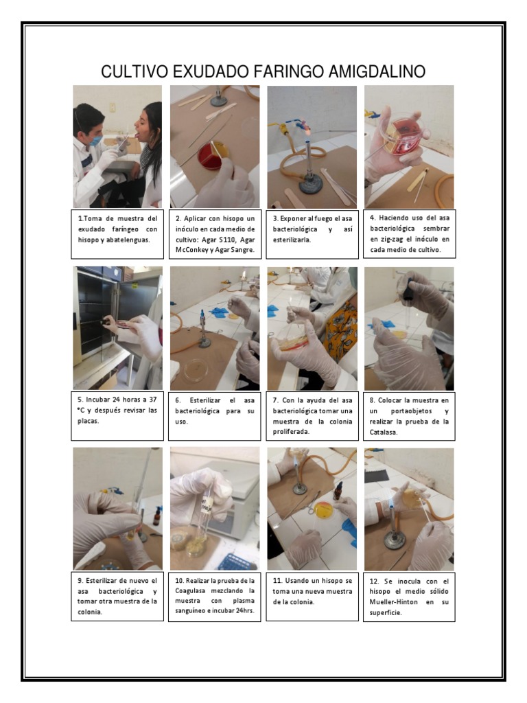 Cultivo Exudado Faríngeo Amigdalino | PDF | Microbiología ...