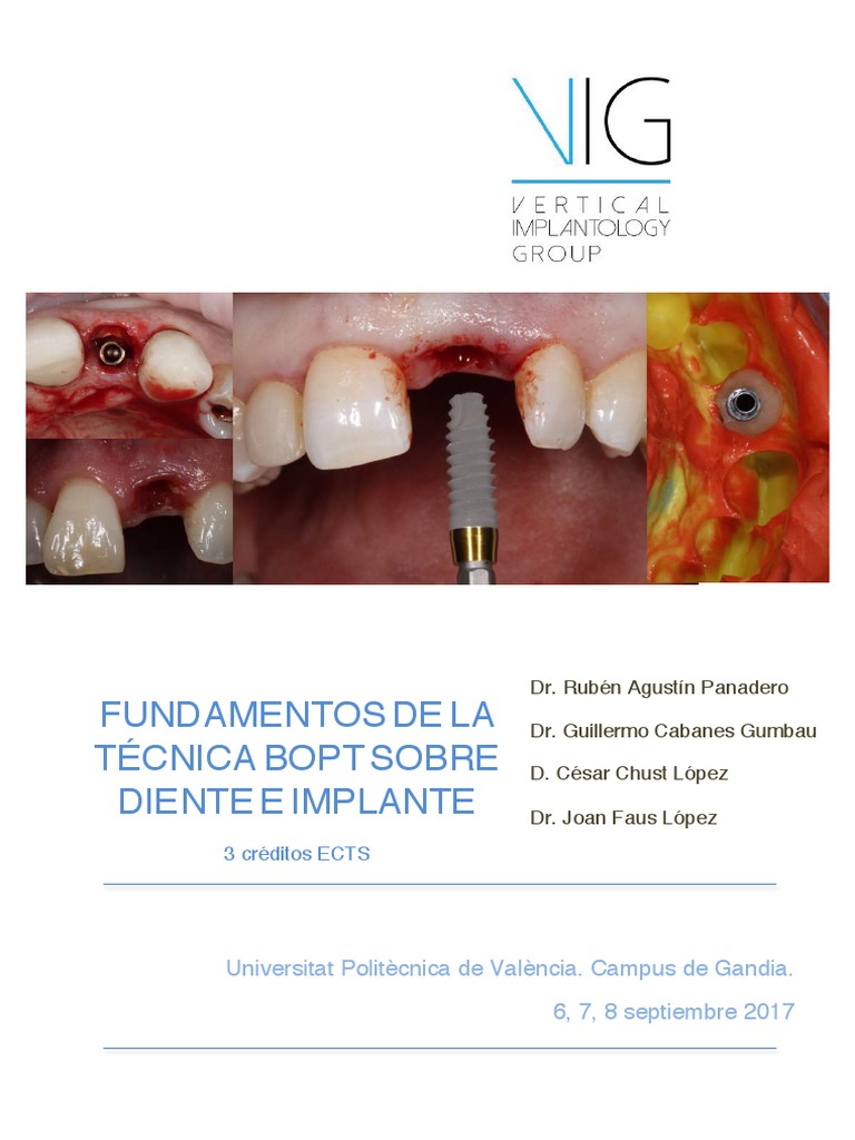 Curso BOPT Diente Implante VIG | PDF | Odontología | Doctorado