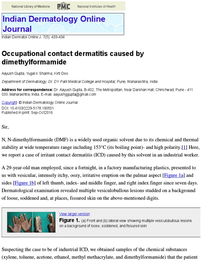 Indian Dermatology Online Journal: Occupational Contact Dermatitis ...