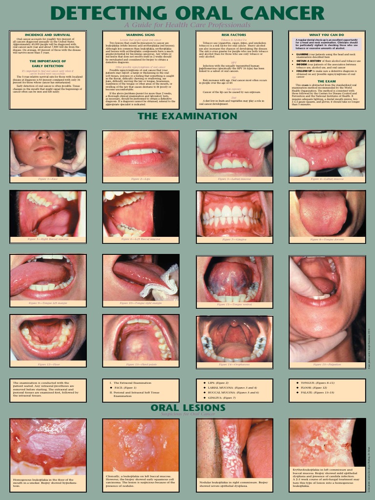 Detecting Oral Cancer | PDF | Head And Neck Cancer | Cancer