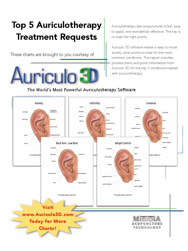 Top 5 Auriculotherapy Charts | Anxiety | Stress (Biology)