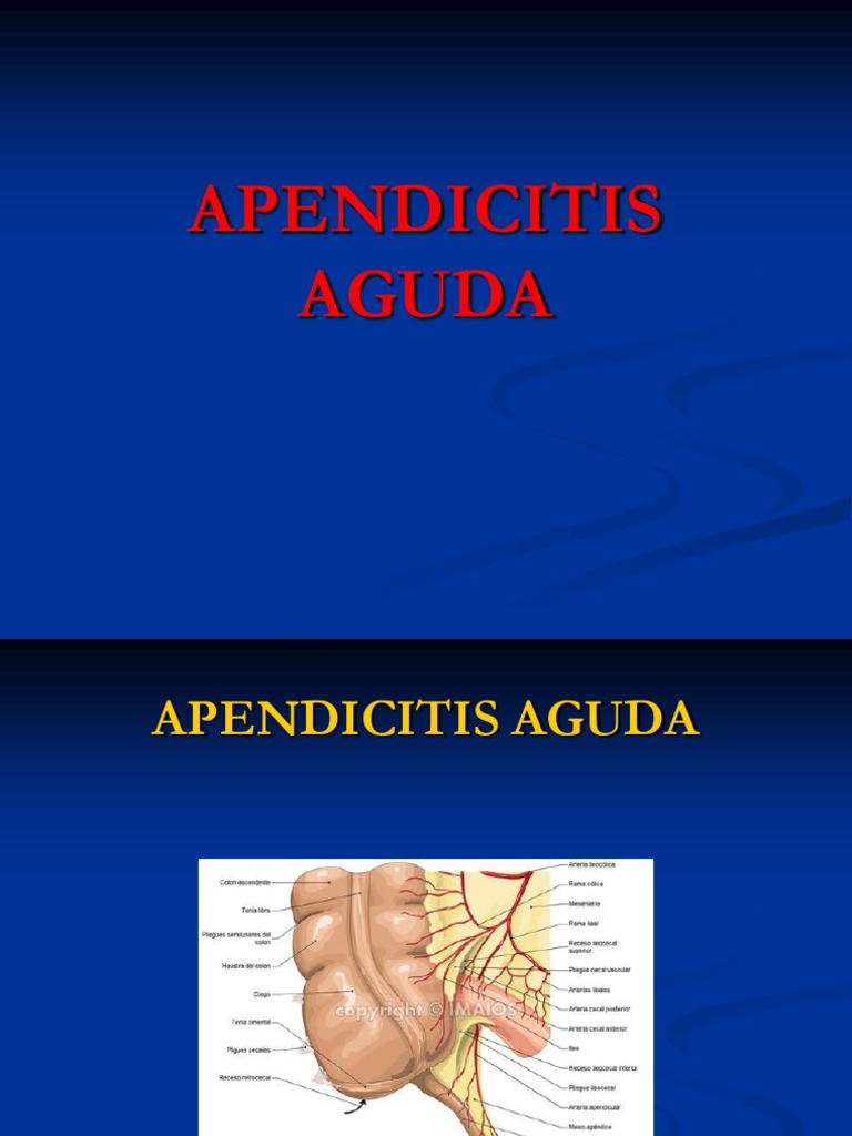 APENDICITIS-AGUDA.ppt | Abdomen | Enfermedades y trastornos humanos