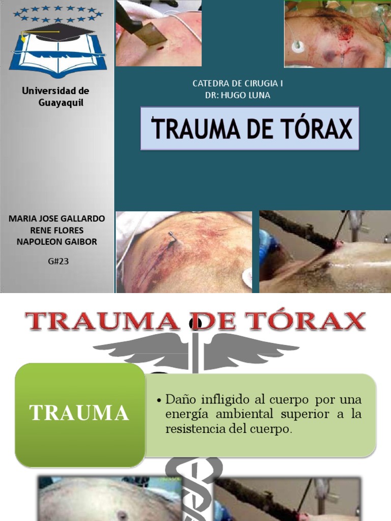 Trauma de Torax | PDF | Lesión | Pulmón