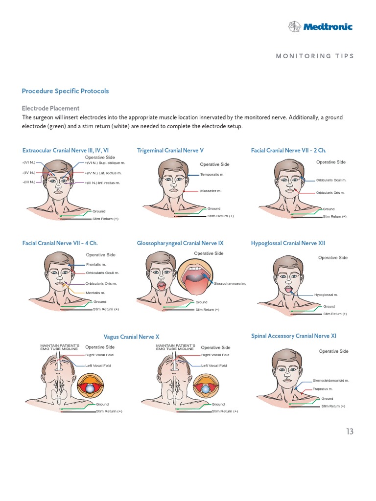 Nim 2.0 System and Et Tube Placement | PDF | Human Head And Neck ...