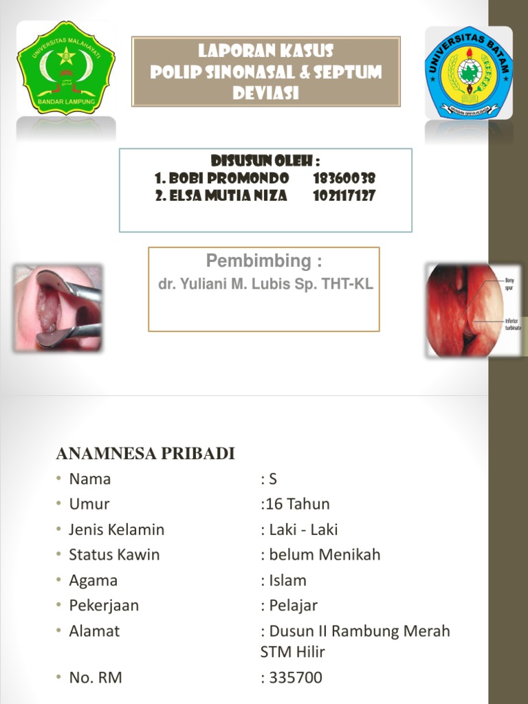 Laporan Kasus Polip Sinonasal+septum Deviasi | PDF