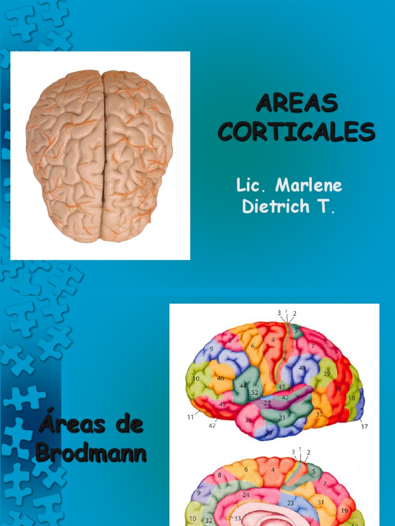 3.2 Areas Corticales (OK) | Afasia | Corteza cerebral