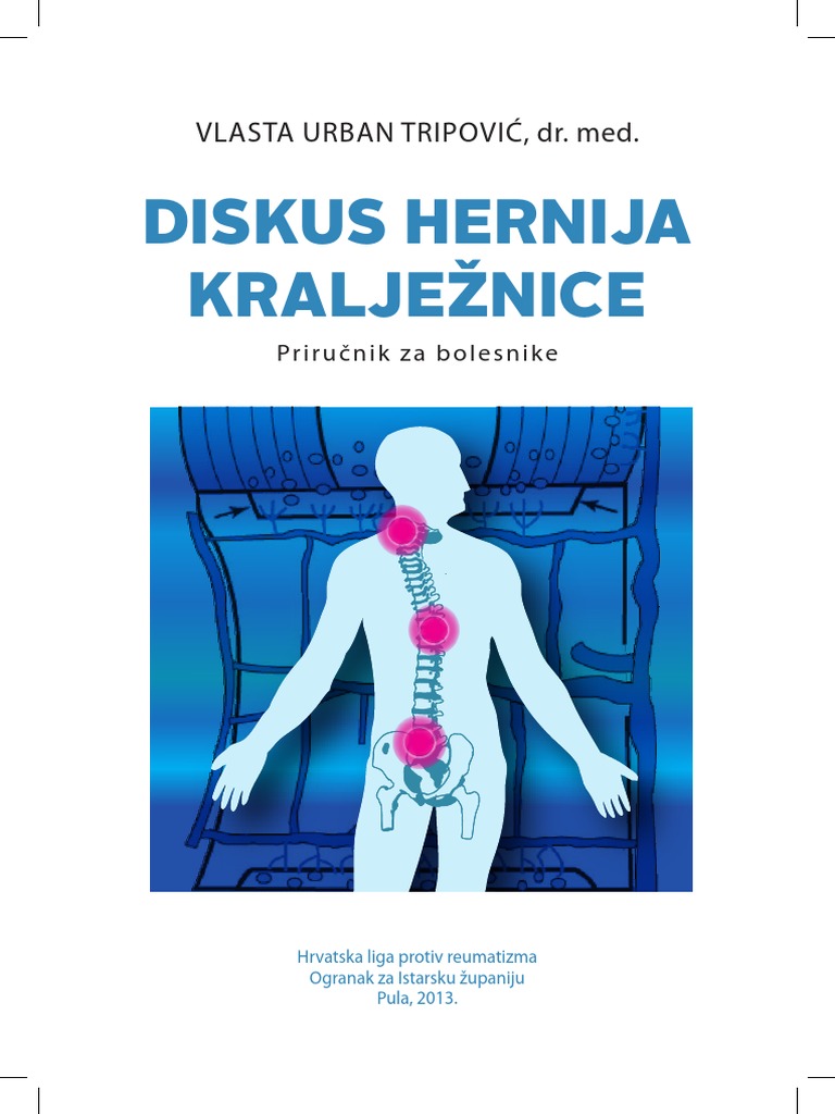 Diskus Hernija Small PDF | PDF