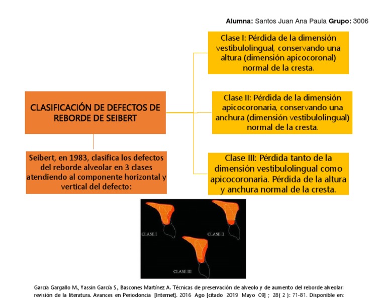 Classification and description of Seibert's classification of alveolar ...