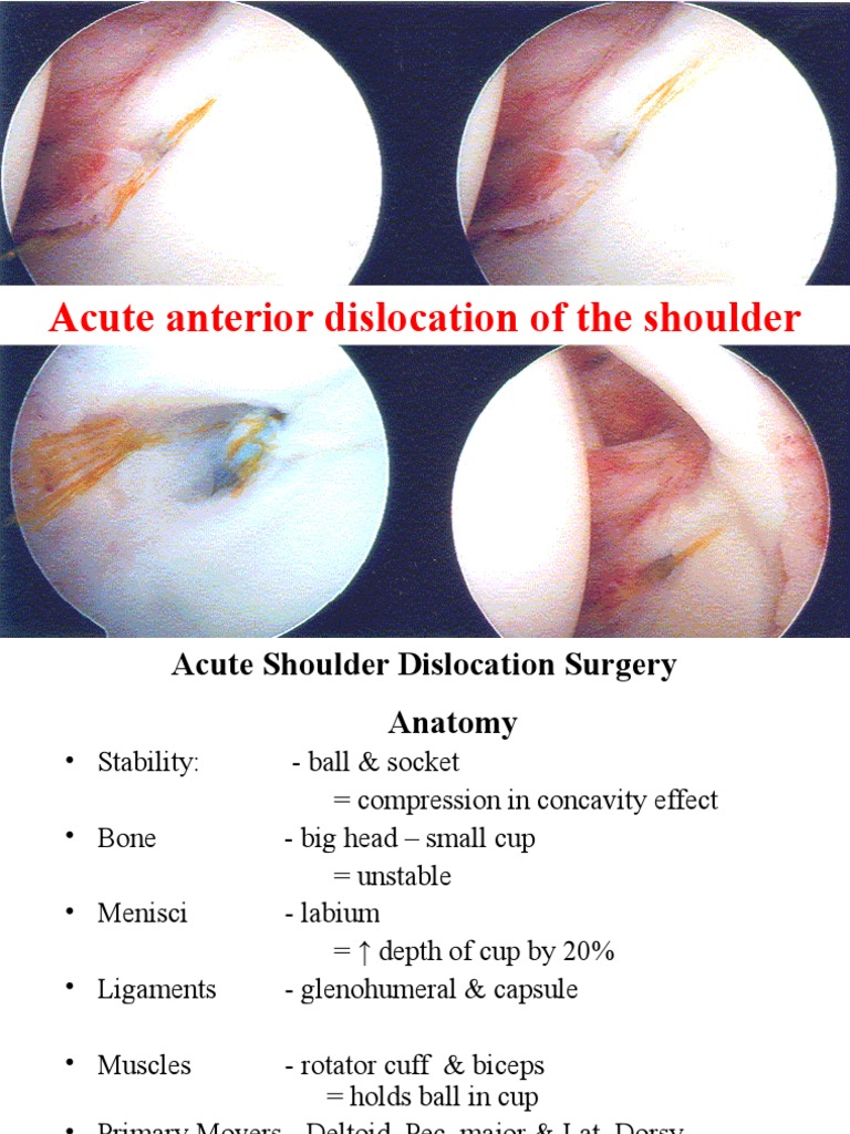 Acute Anterior Dislocation of The Shoulder: Einoder | PDF | Shoulder ...
