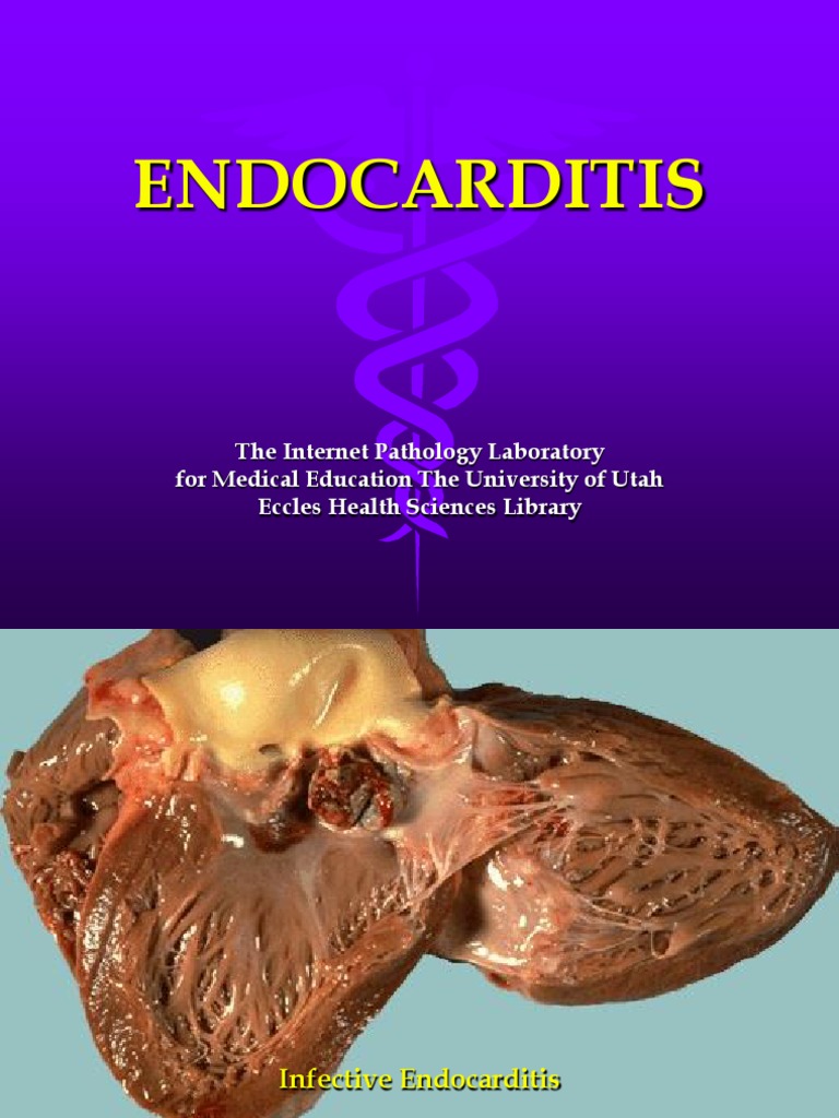 Endocarditis | PDF | Heart Valve | Internal Medicine
