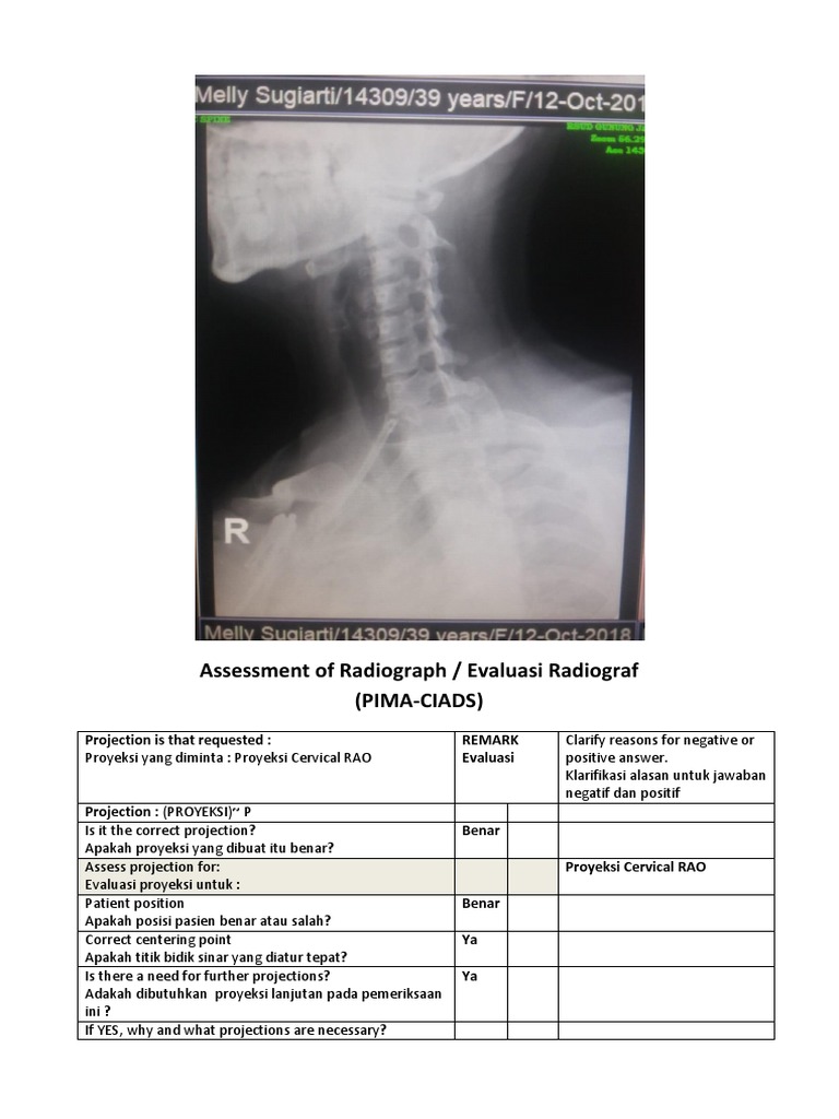 Assessment of Radiograph Cervical RAO | PDF