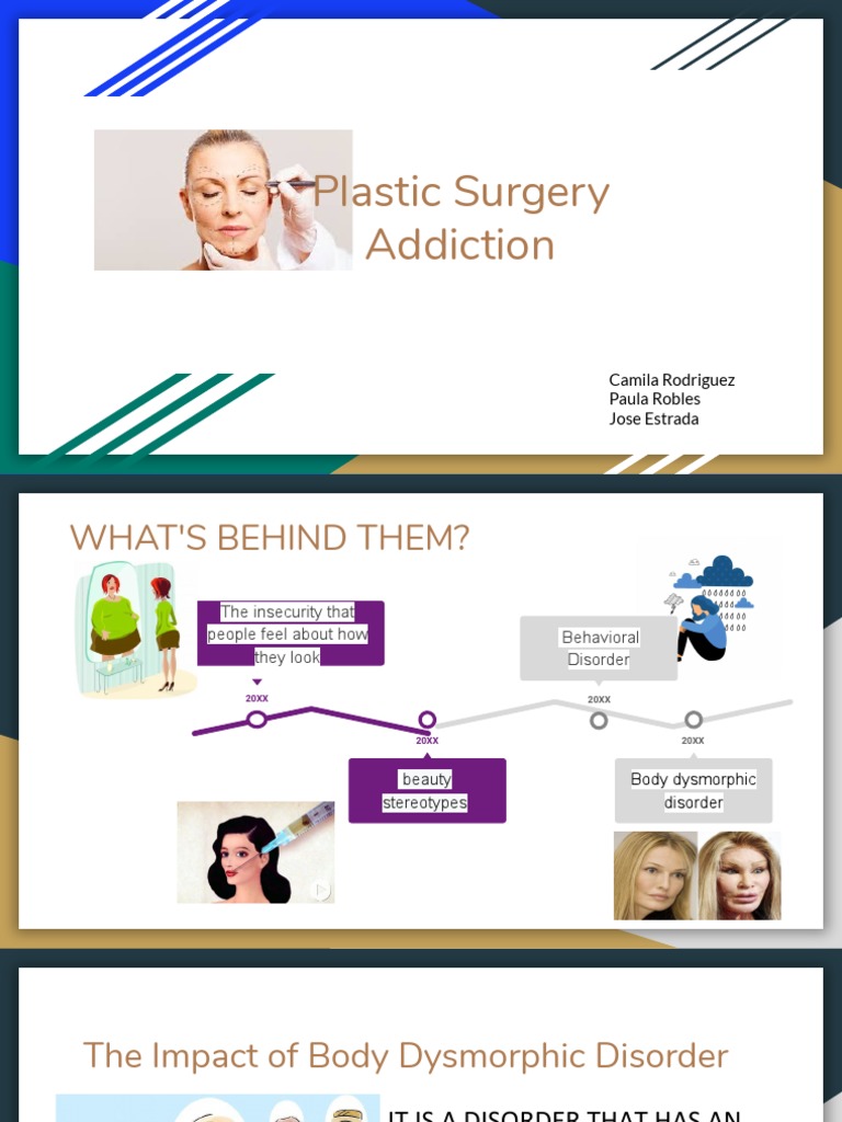 Plastic Surgery Addiction: Camila Rodriguez Paula Robles Jose Estrada | PDF