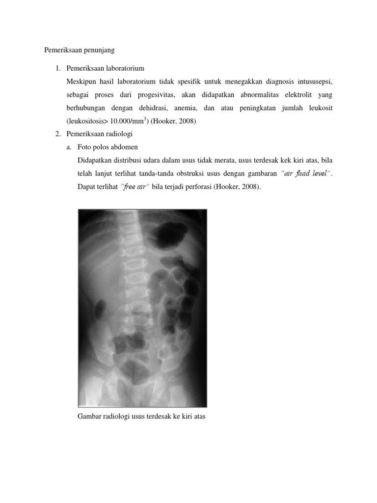 Intususepsi Pemeriksaan Penunjang | PDF