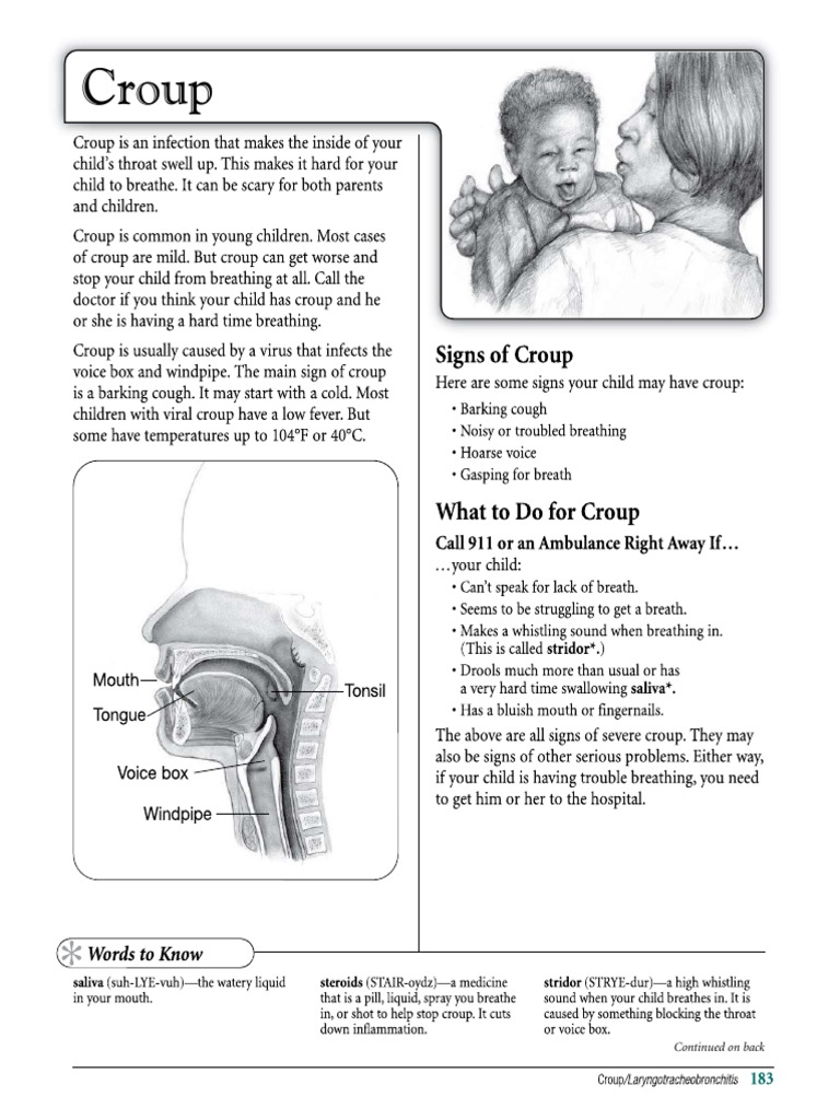 Croup Education | PDF