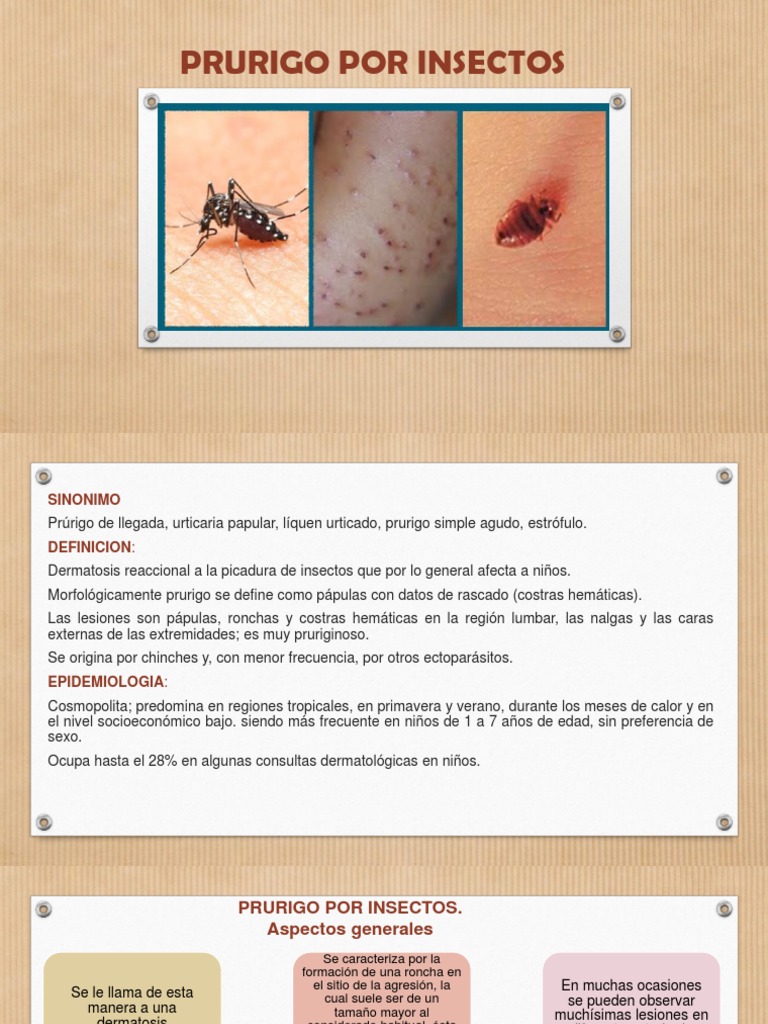 Prurigo Por Insectos | Sistema inmune | Inmunología