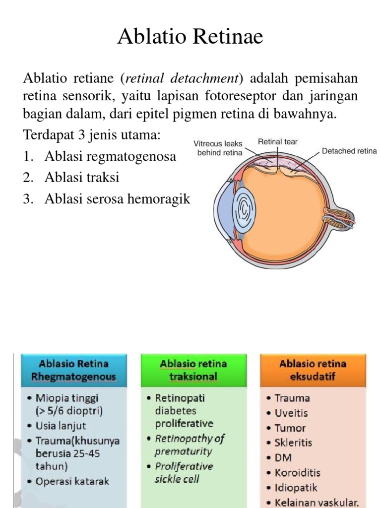Ablatio Retinae | PDF