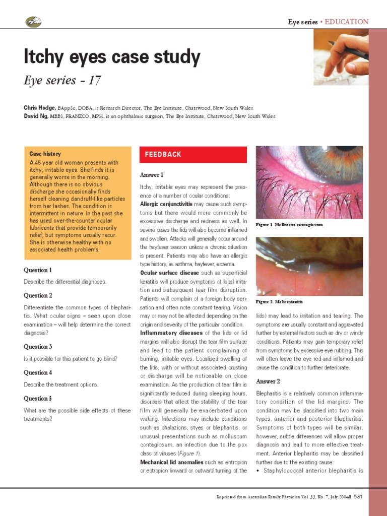 Blepharitis | PDF | Ophthalmology | Medical Specialties