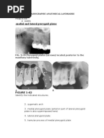 Panoramic Radiograph Interpretation Guide | PDF | Dental Anatomy ...