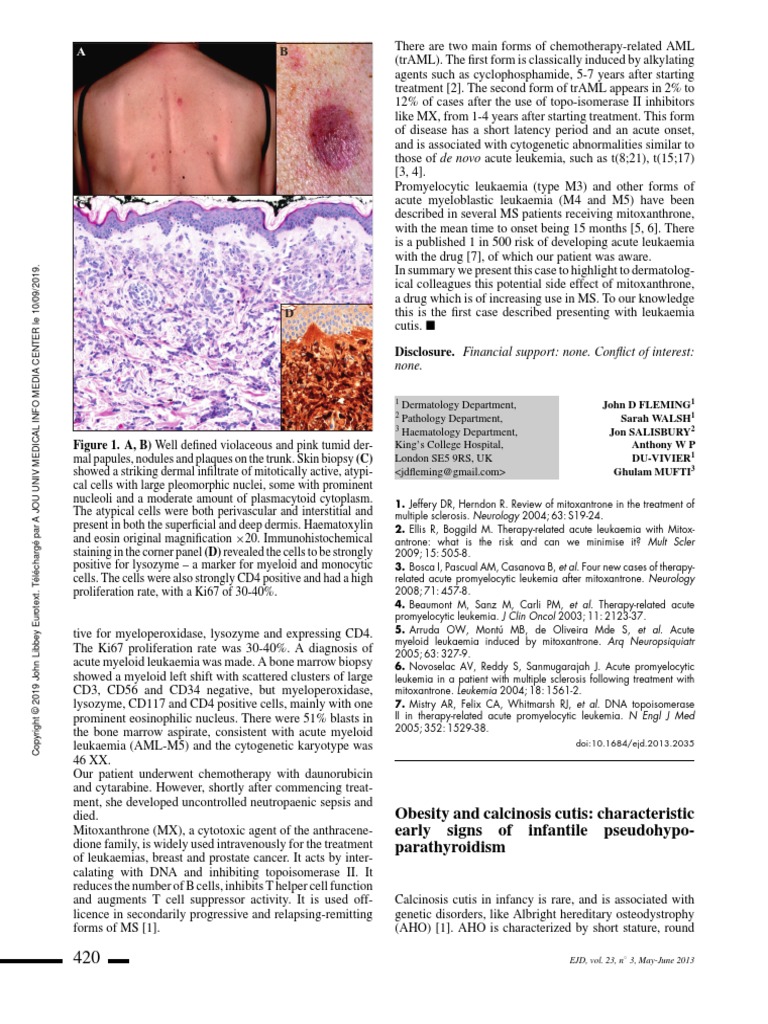 Obesity and Calcinosis Cutis - Characteristic Early Signs of Infantile ...