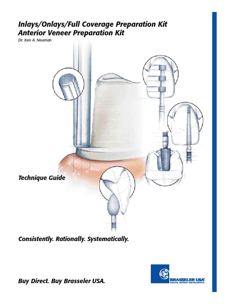 Inlay/Onlay Preparation Techniques Guide | PDF | Dentistry Branches | Mouth