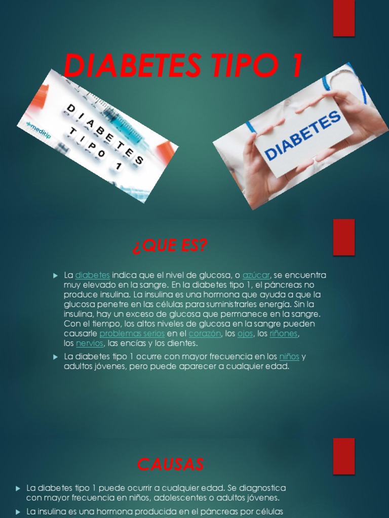 Diabetes Tipo 1 | PDF | Diabetes mellitus tipo 1 | Diabetes mellitus