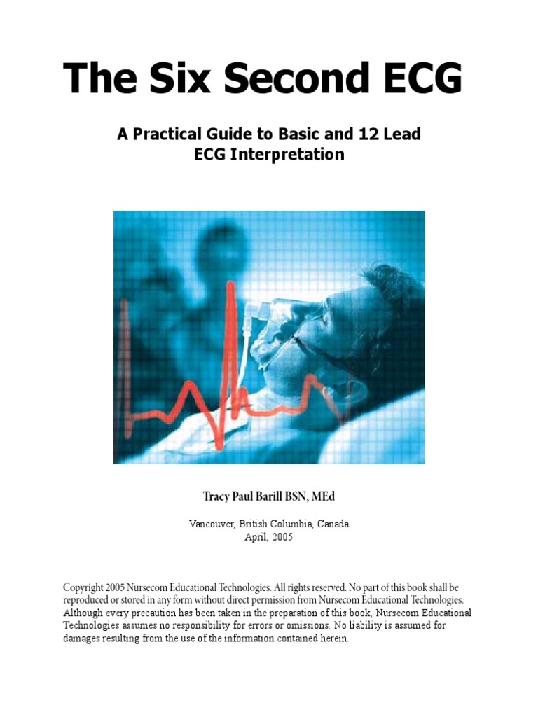The Six Second ECG: A Practical Guide To Basic and 12 Lead ECG ...