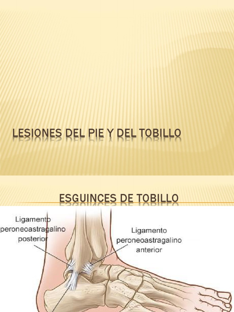 4 - Lesiones Del Pie - Core | PDF | Tobillo | Pie