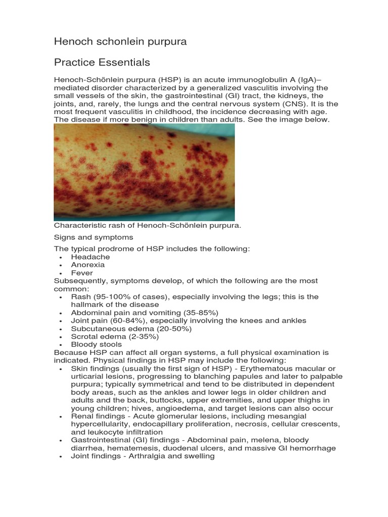 An Overview of Henoch-Schönlein Purpura: Signs, Symptoms, and Physical ...