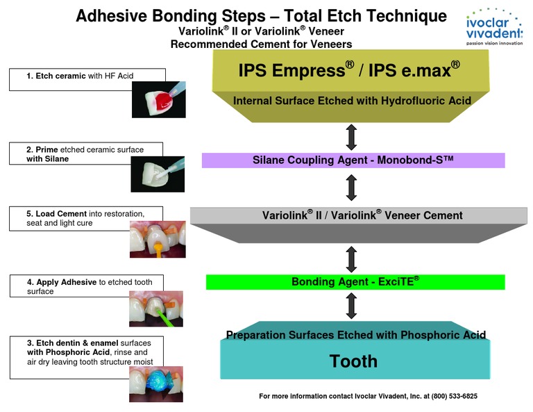 Adhesion Steps Total Etch Emax Empress | PDF