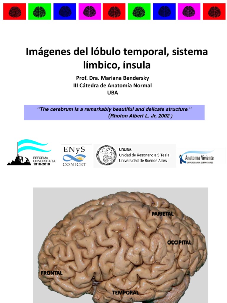 RMN Temporal + Insula | PDF | Lóbulo temporal | Tálamo