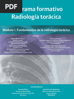 Ángulo de Louis | PDF | Tórax | Anatomía humana