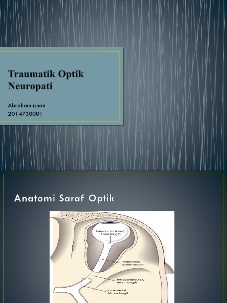 Traumatik Optik Neuropati | PDF