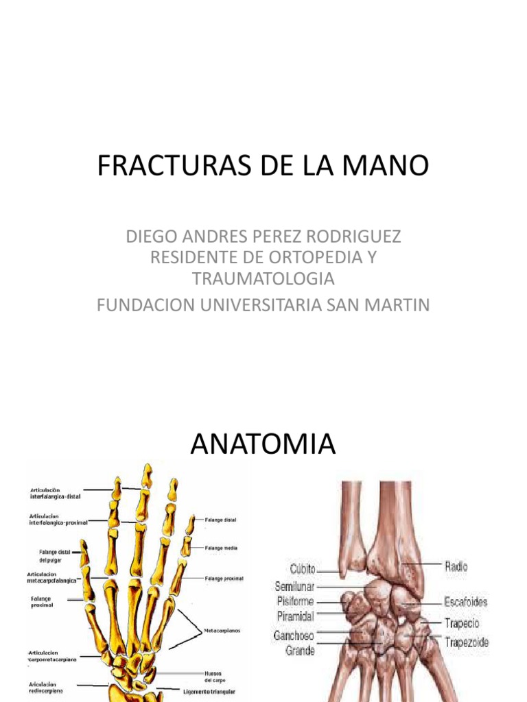 Fractura de Mano | PDF | Traumatologia | Trastornos musculoesqueléticos