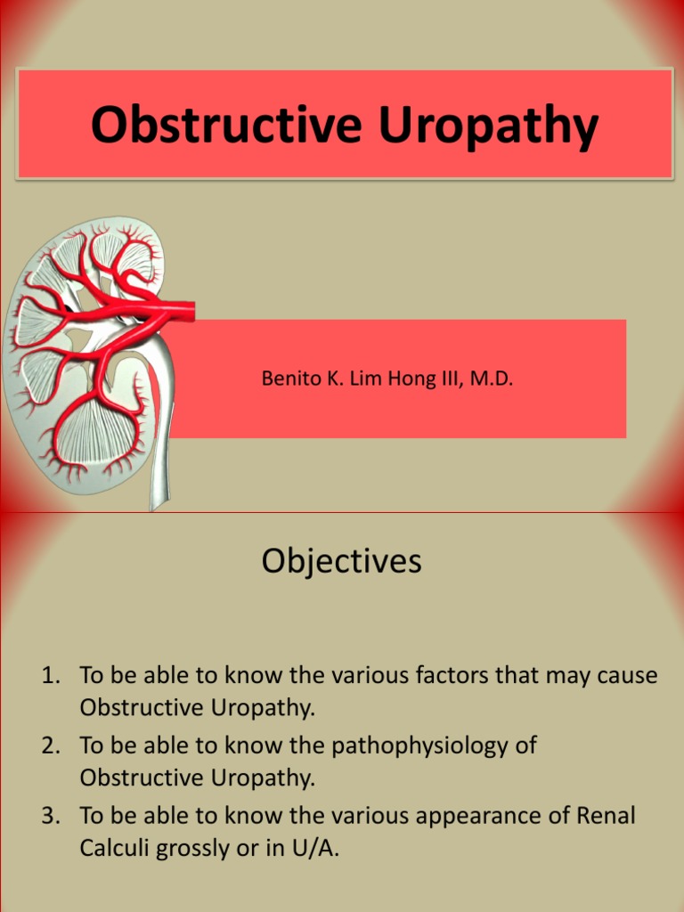 Understanding Pediatric Obstructive Uropathy | PDF | Clinical Medicine ...
