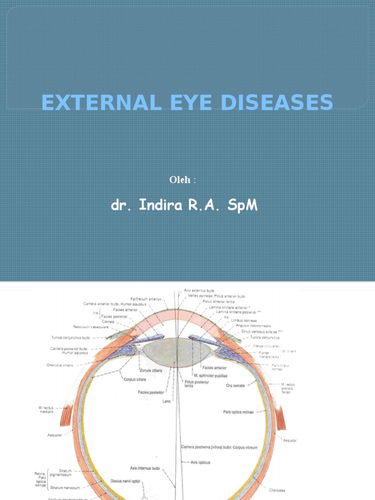 External Eye Diseases: Dr. Indira R.A. SPM | PDF | Sains & Matematika