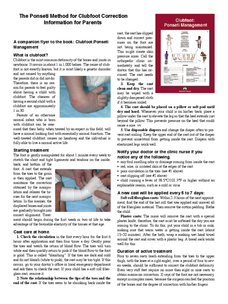 Ponseti Method for Clubfoot Care | PDF | Foot | Shoe