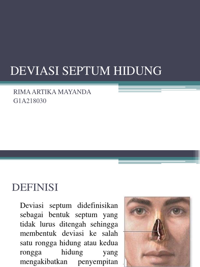 Deviasi Septum Nasi | PDF