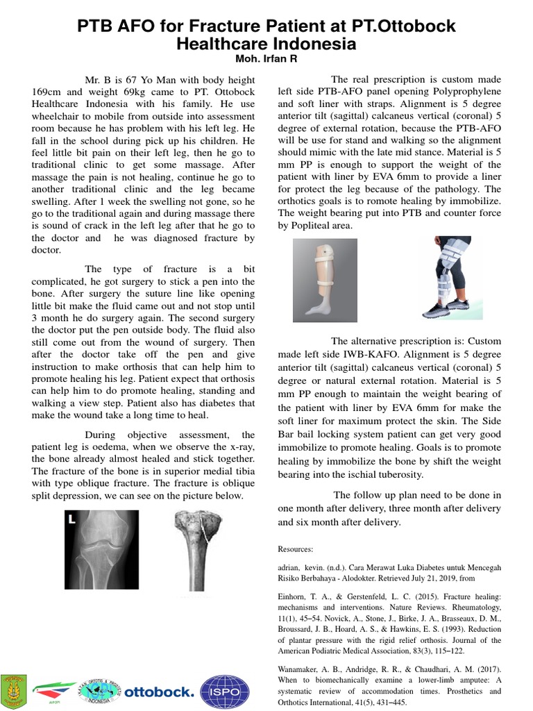 PTB AFO For Fracture Patient at PT - Ottobock Healthcare Indonesia ...