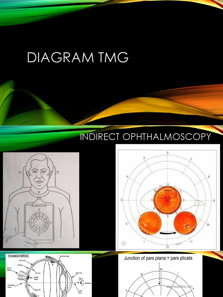 Diagram TMG | PDF | Retina | Ophthalmology