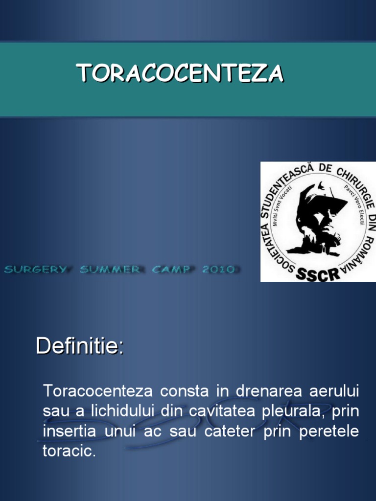 Toracocenteza | PDF