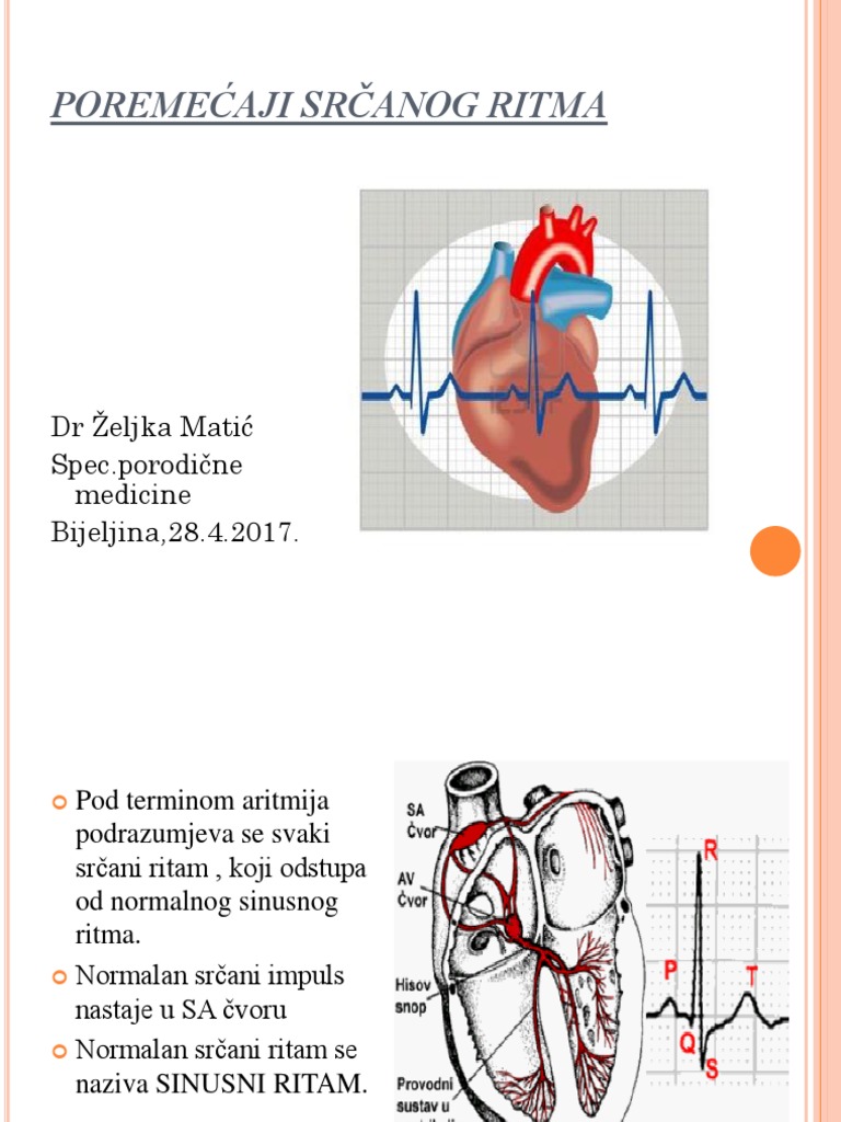 Poremećaji Srčanog Ritma | PDF