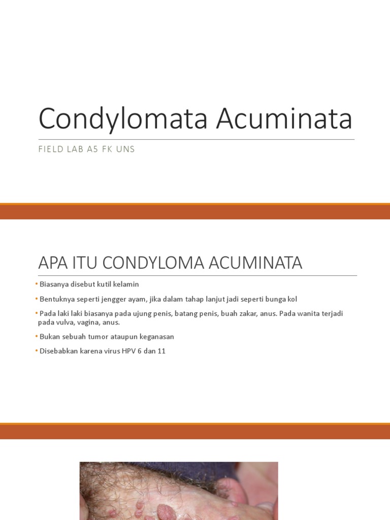 Panduan Lengkap Condylomata Acuminata | PDF