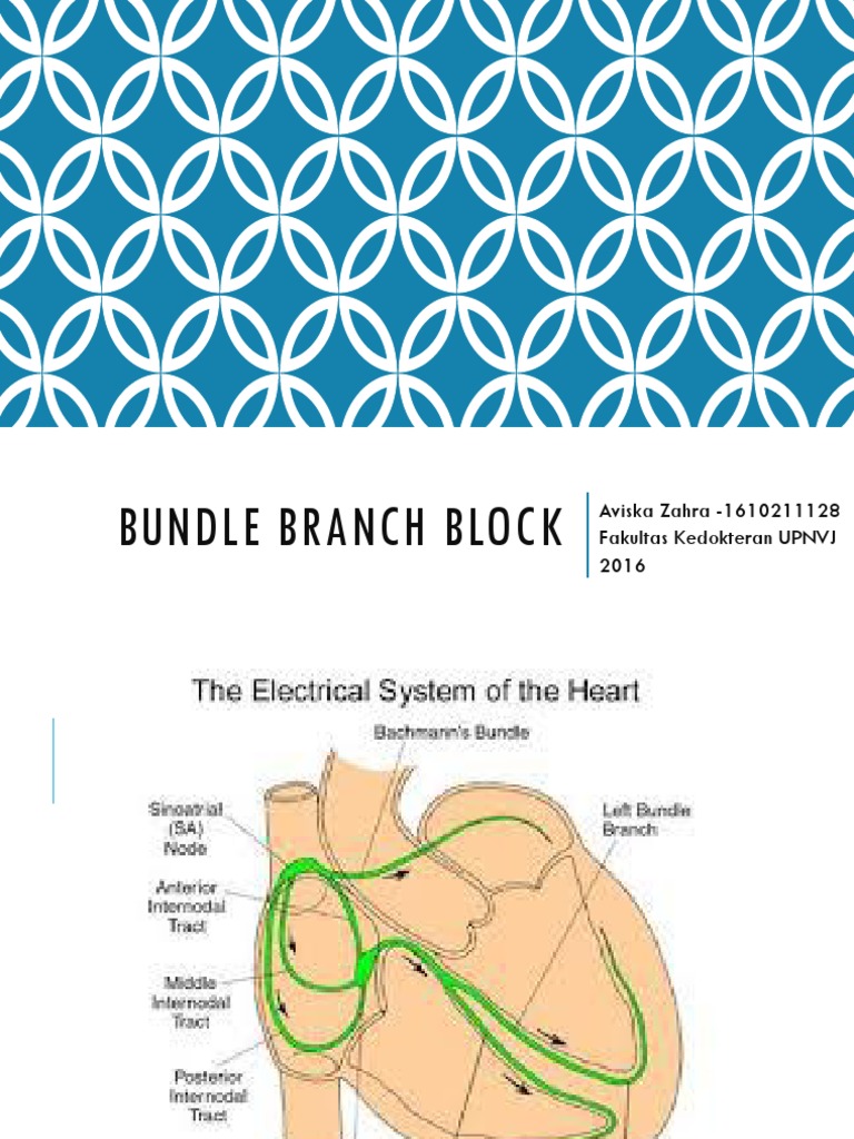 Bundle Branch Blocks | PDF